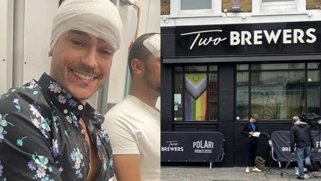 Clapham stabbing: Victim speaks out after Two Brewers incident