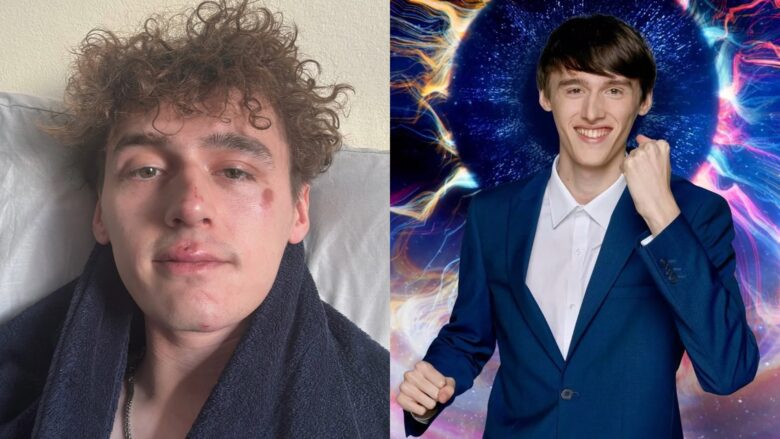 Big Brother winner Cameron Cole suffers homophobic attack - Attitude